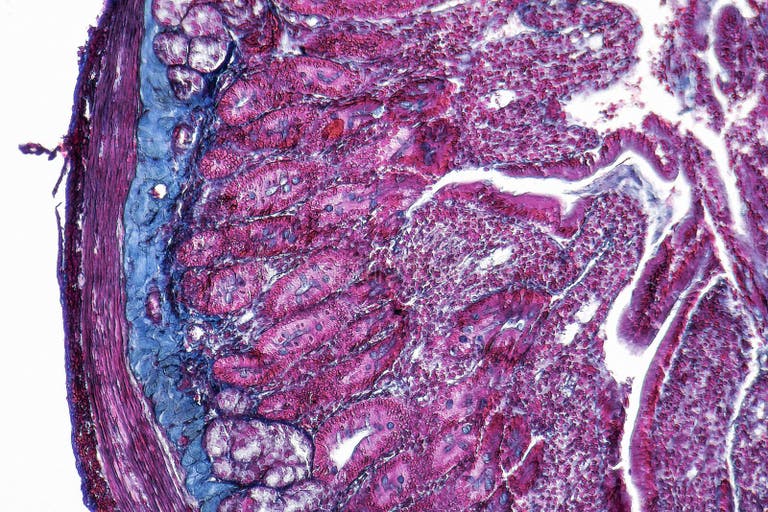 Duodenum cross section stock photo. Image of medicine - 83131034