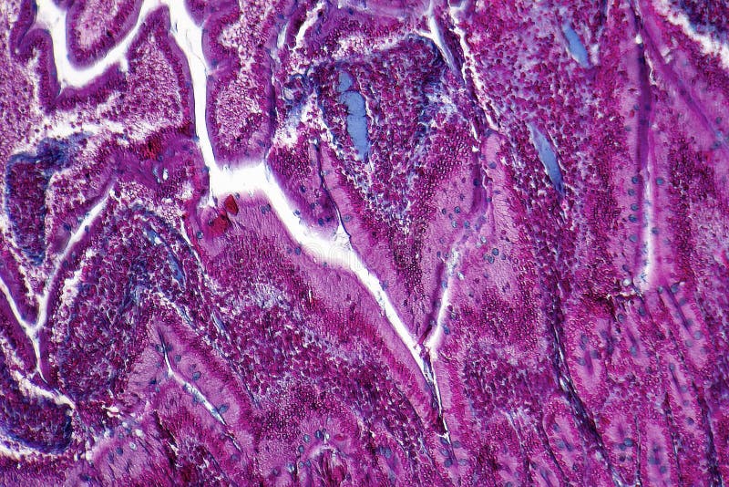 Duodenum cross section stock photo. Image of medicine - 83130882