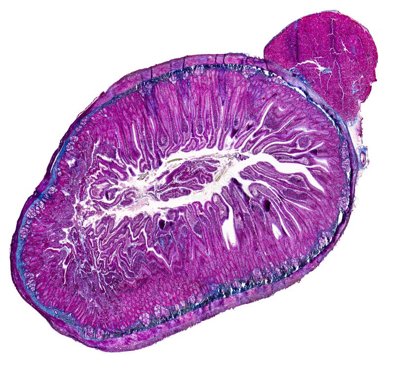Duodenum cross section stock photo. Image of dodecadactylum - 83131050