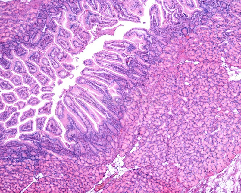 Duodenum Glândulas De Brunnerâ€™s Foto de Stock - Imagem de muco ...