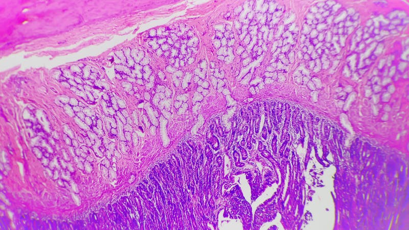 Duodenum of the Human Being in Section Shown Under Microscope with 40x ...