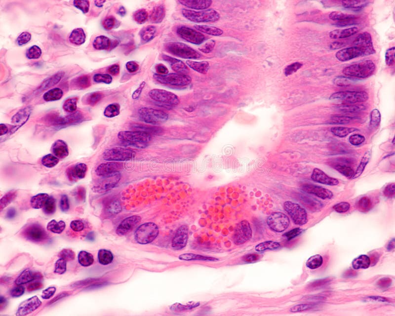 Duodenum. Paneth cells stock photo. Image of small, digestive - 117240114