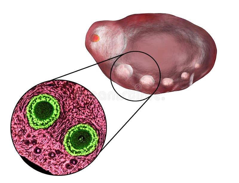 In Dwarsdoorsnede Van Een Eierstok Stock Illustratie - Illustration of ...