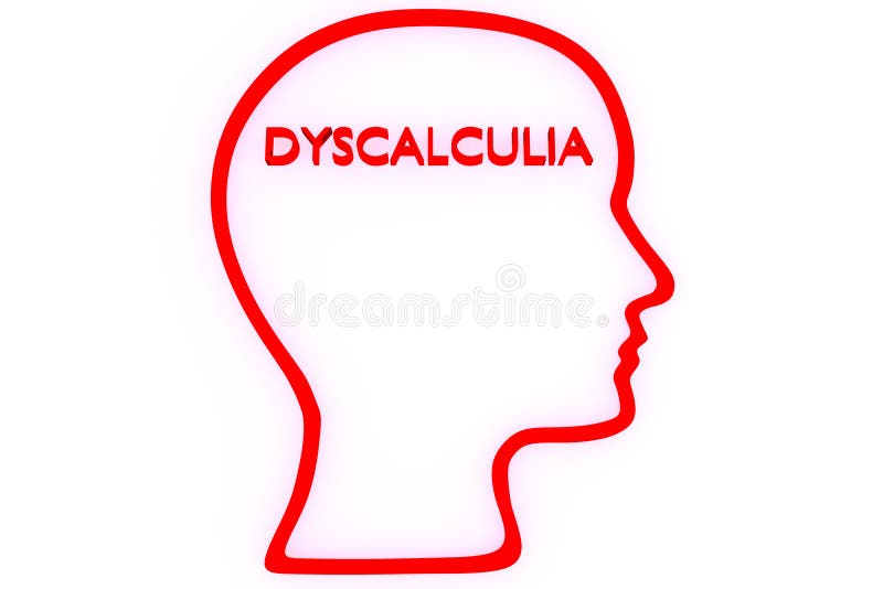 DYSCALCULIA - Disorder Concept Stock Illustration - Illustration of ...
