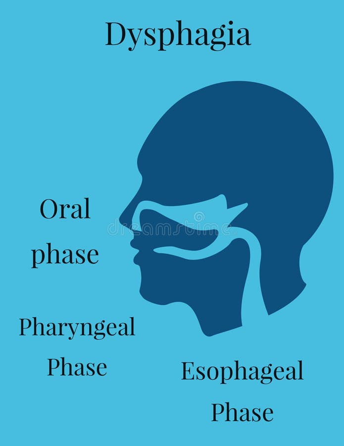 Swallowing Therapy Stock Illustrations – 63 Swallowing Therapy Stock ...