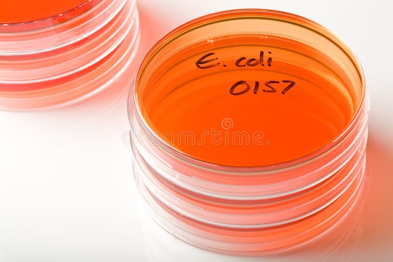 2,877 Escerichia Coli Stock Photos - Free & Royalty-Free Stock Photos ...
