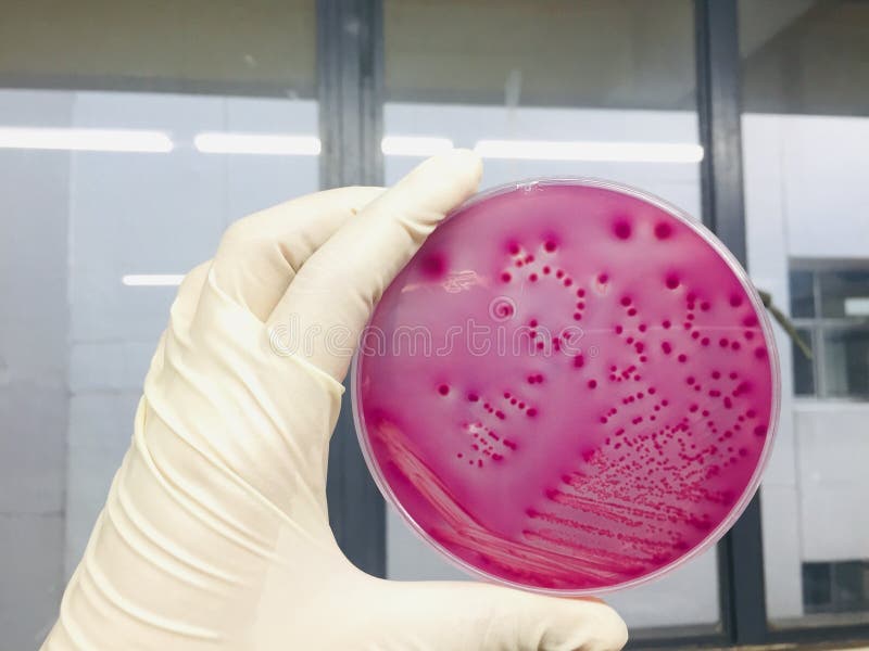 E.coli on VRB agar stock photo. Image of isolated ...