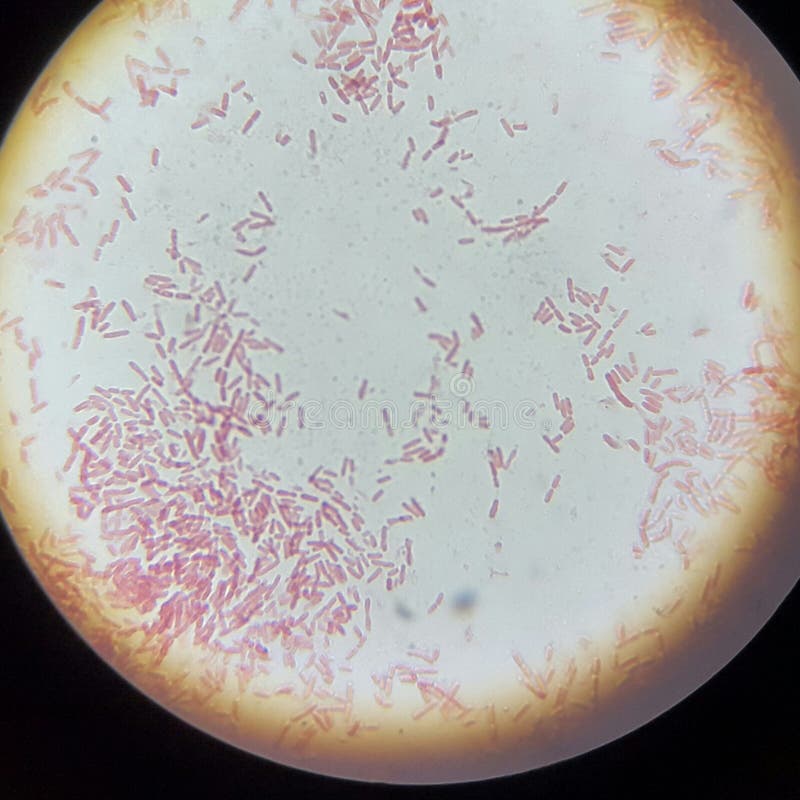 E Coli Gram Stain 100x