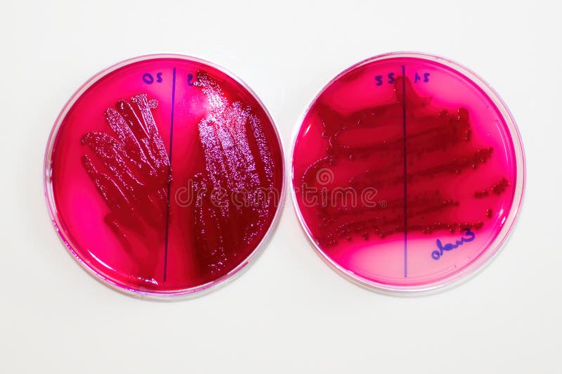 E Coli Bacteria Grow Characteristics on Selective Media Stock Image ...