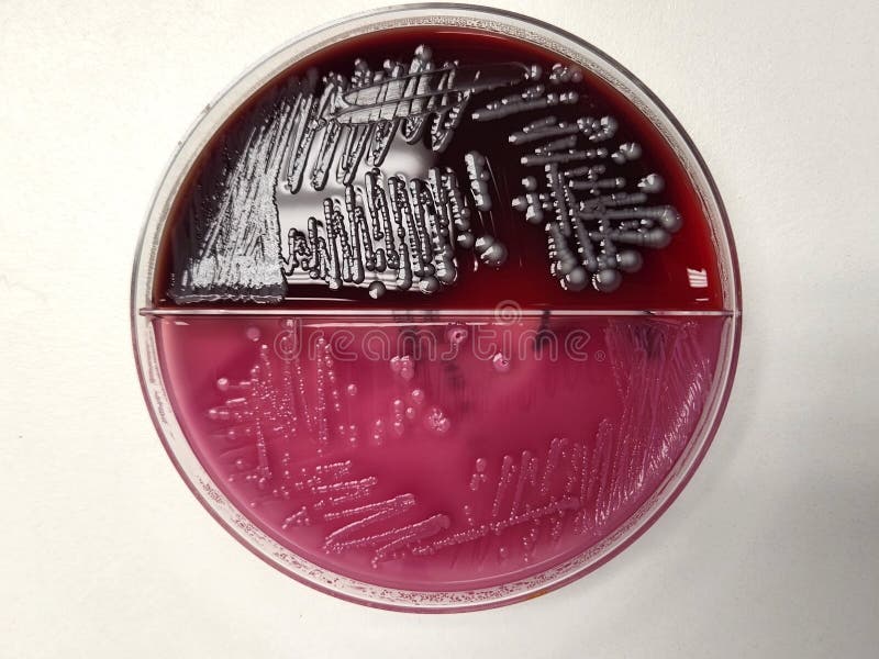 E. Coli Bacteria Growing on Blood and Macconkey Agar Stock Photo ...