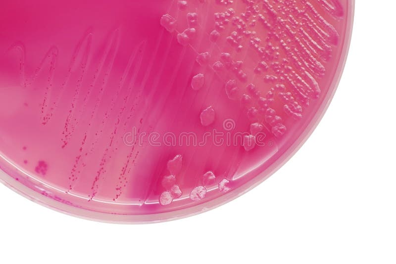 E.coli Bacterial Colonies on MacConkey Agar Plate Stock Photo - Image ...