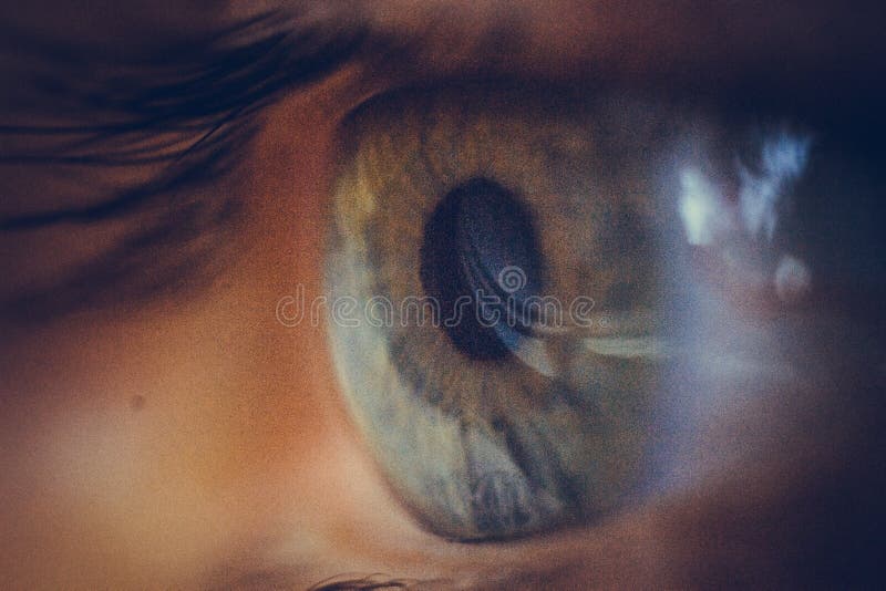 Macro Yeux Avec Des Vaisseaux Sanguins éclatants Oeil Couvert De Sang ...