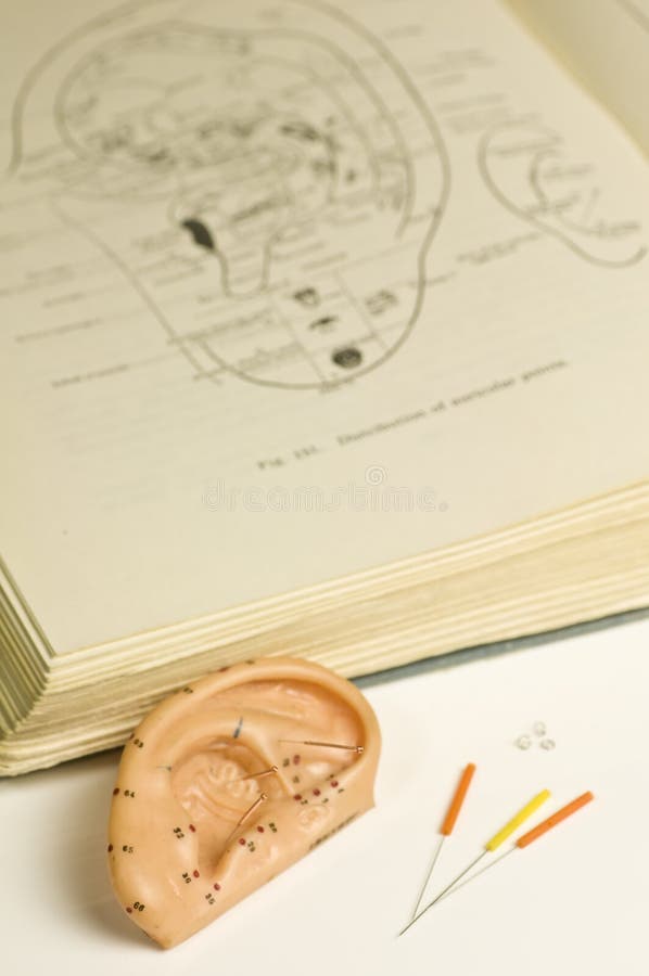 Ear acupuncture stock image. Image of health, healthcare - 28929881