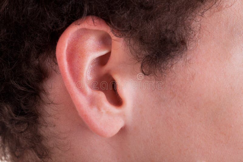 Earwax in the Dirty Ear of a Child. Hole Ear of Human, Wax on Hair and ...