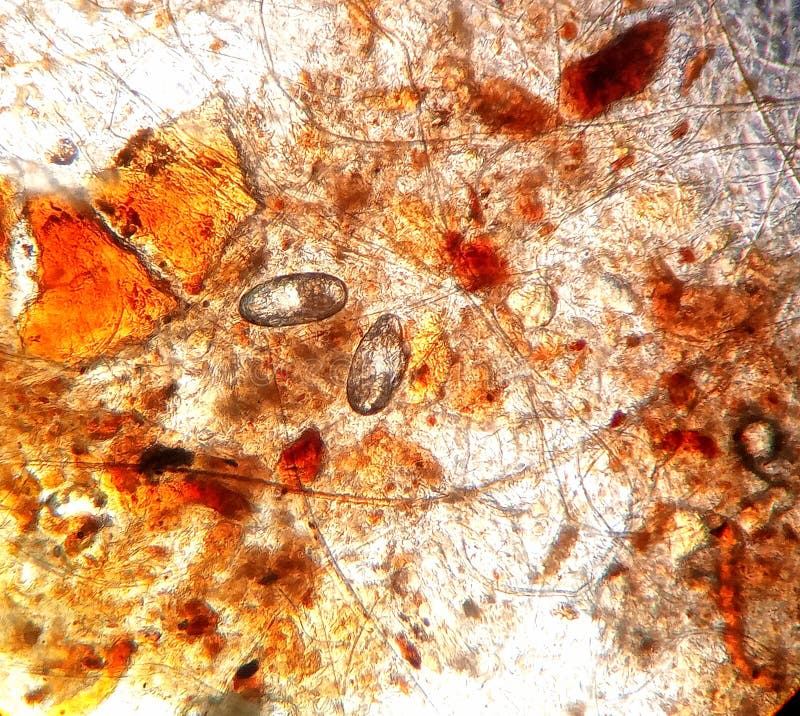 Ear Mite Egg from a Cat, Under the Microscope Stock Image - Image of ...