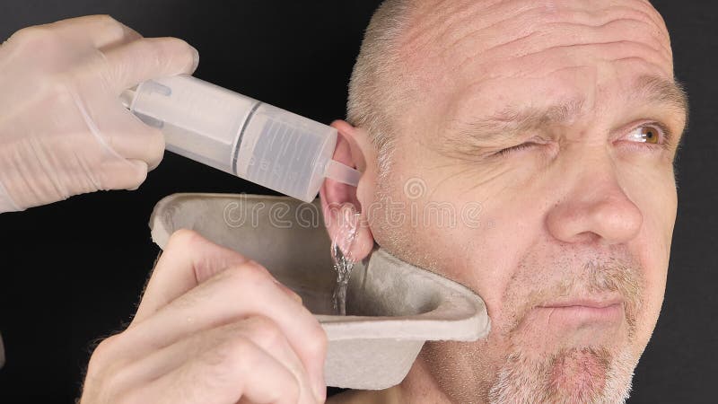 An Ear Rinsing Procedure on the Left Ear Stock Video - Video of ...