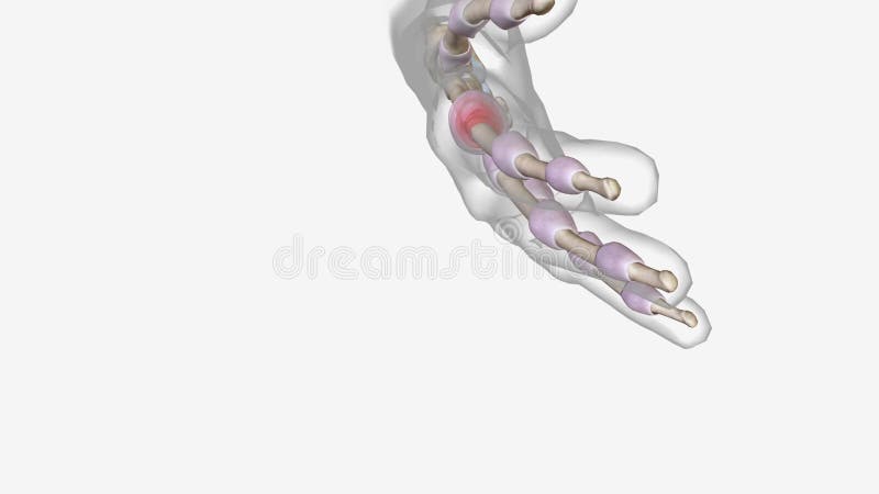 Pain in the Arthritic Knee Joint, Knee Painful, Skeleton X-ray ...