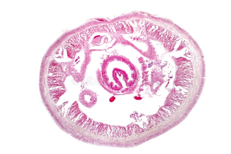 Earthworm Cross Section Under Microscope