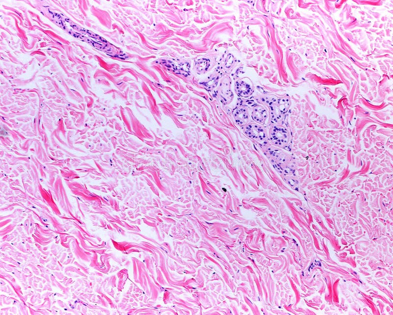 Eccrine Sweat Gland. Excretory Duct Stock Image - Image of microscope ...