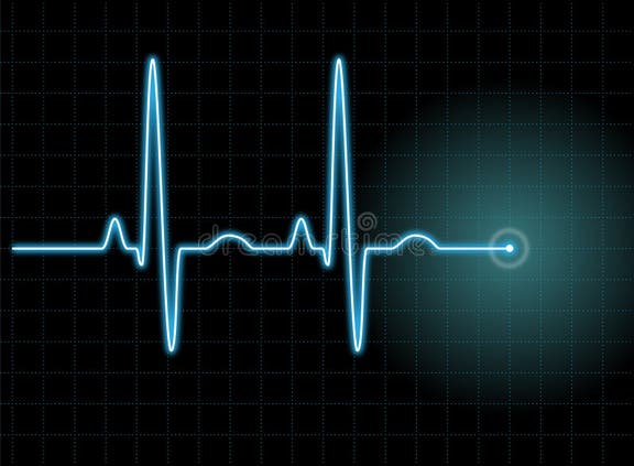 ECG stock illustration. Illustration of electrocardiogram - 1734292