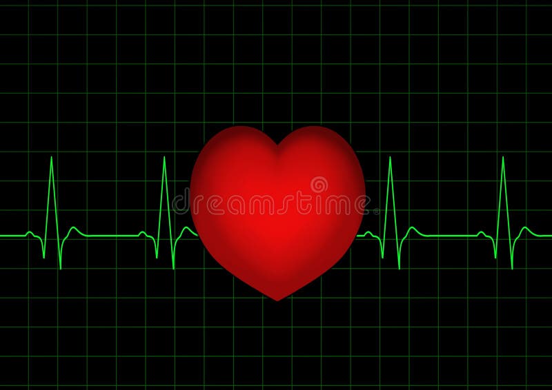 Heart Rhythm Set, Electrocardiogram, ECG - EKG Signal, Heart Beat Pulse ...