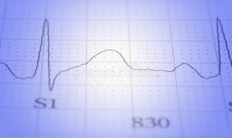 ECG stock image. Image of blood, laboratory, measurement - 2300995