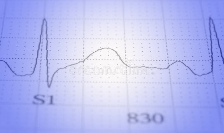 288 Normal Ecg Stock Photos - Free & Royalty-Free Stock Photos from ...