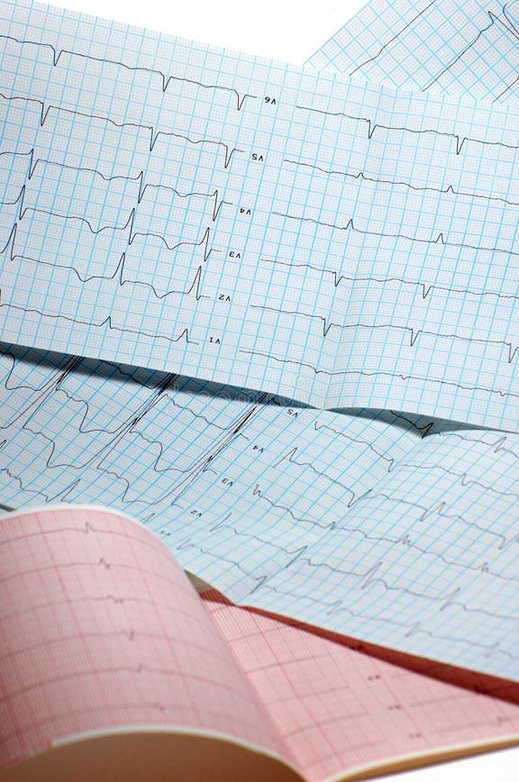 Ecg stock photo. Image of analyze, electric, electrocardiogram - 3661458