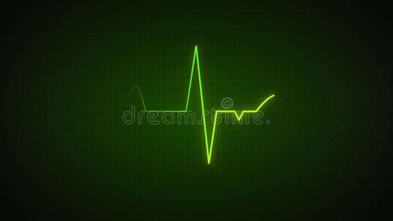 ECG Animation stock footage. Video of cardiologist, anatomy - 44753406