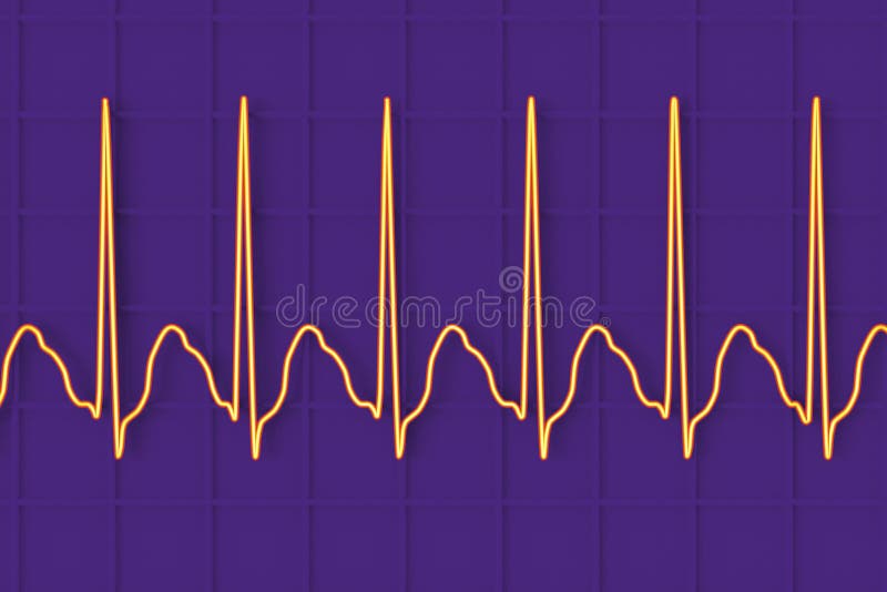 Ecg In Atrial Flutter 3d Illustration Stock Illustration