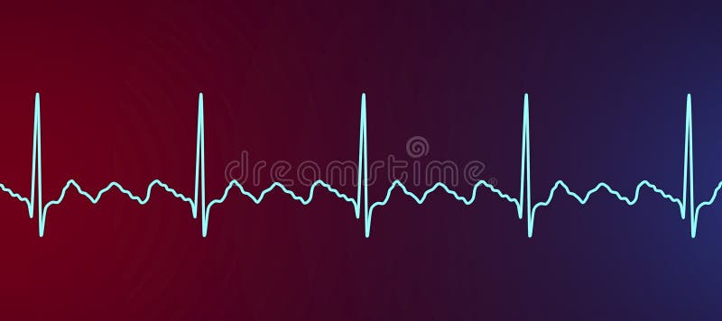 ECG in Atrial Flutter, 3D Illustration Stock Illustration ...