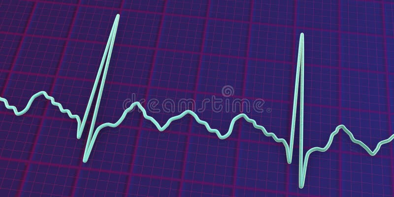 ECG in Atrial Flutter, 3D Illustration Stock Illustration ...