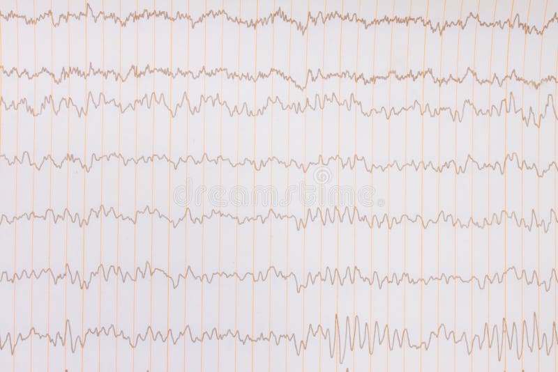 Imaging of Electroencephalography Recording of Human Stock Photo ...