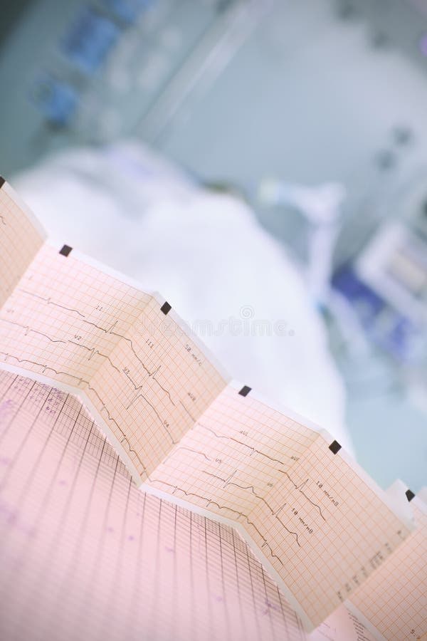 ECG Chart on the Table in Patient Ward Stock Photo - Image of heartbeat ...