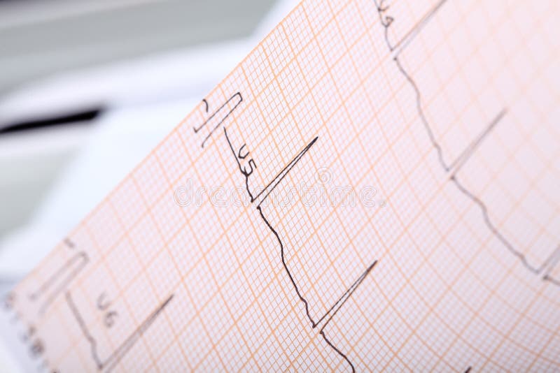 ECG complex on the paper stock image. Image of human - 79587251