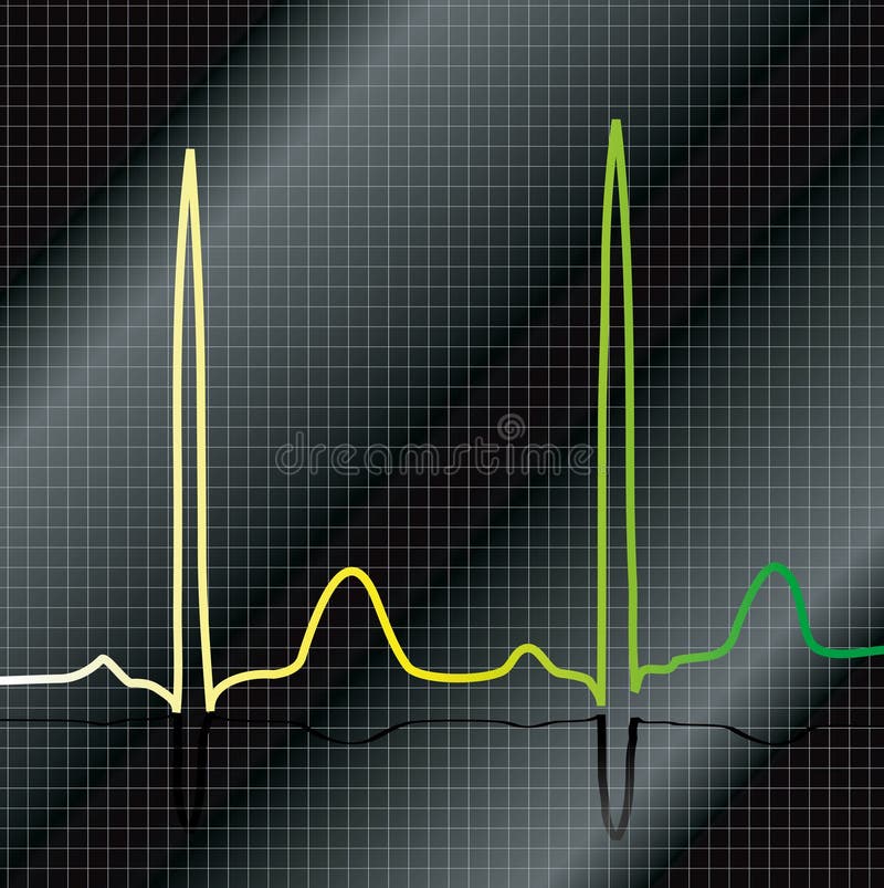 ECG illustration stock. Illustration du médecine, contrôle - 20142937