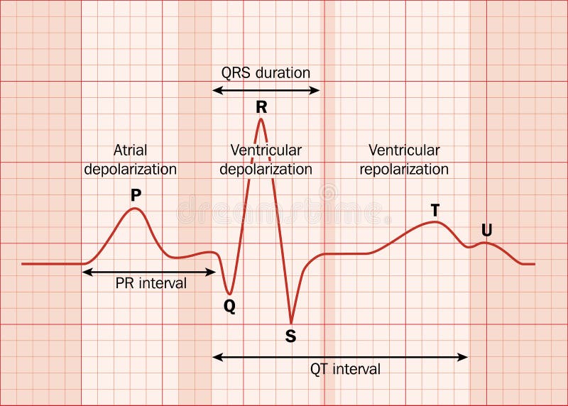 Ecg del corazón ilustración del vector. Ilustración de intervalos ...