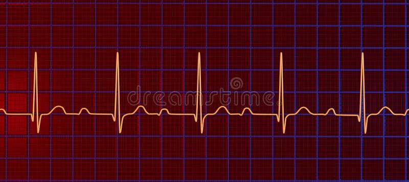 An ECG Displaying 1st Degree AV Block, 3D Illustration Stock ...