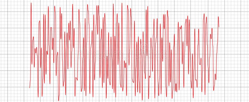 ECG graph stock illustration. Illustration of cardiology - 1058678