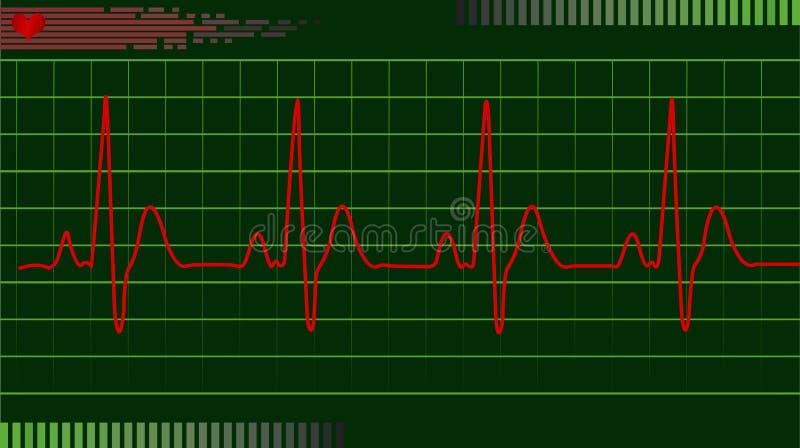 ECG EKG stock illustration. Illustration of attack, electrocardiogram ...