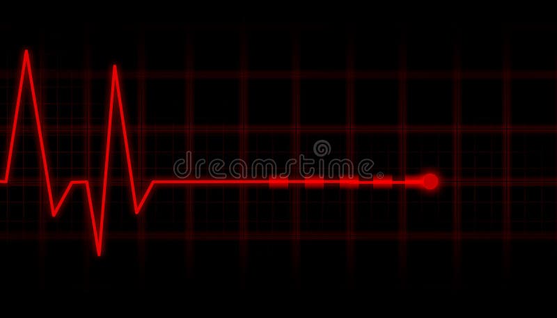 ECG Electrocardiogram Picture. Image: 20171290