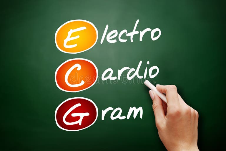 ECG - Electrocardiogram Acronym, Concept on Blackboard Stock Photo ...