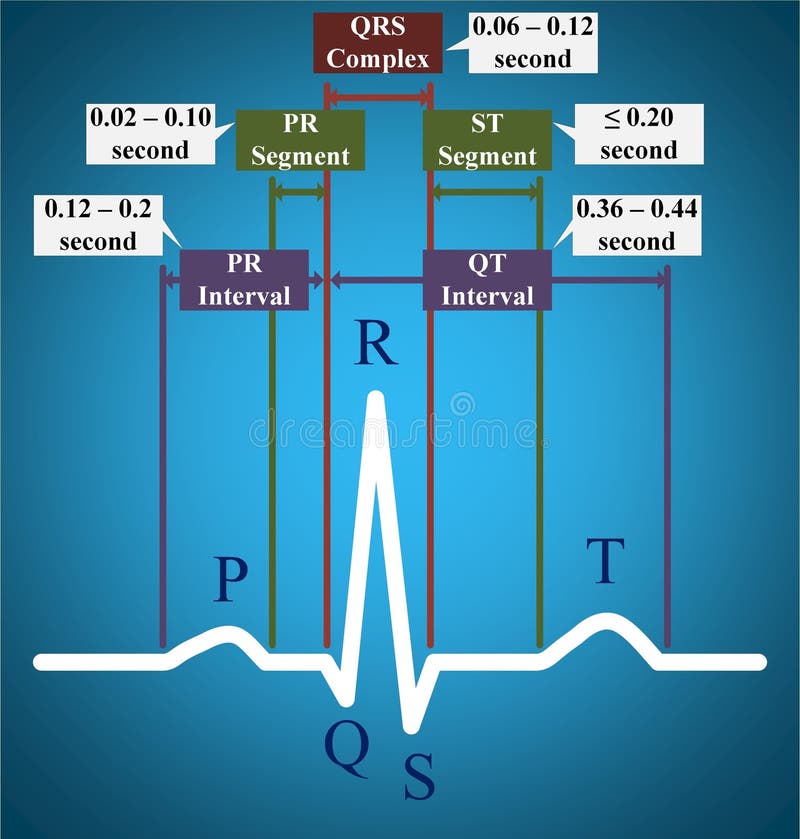 ECG or Electrocardiogram Showing Normal Time Duration Stock ... ECG or Electrocardiogram Showing Normal Time Duration Stock ...