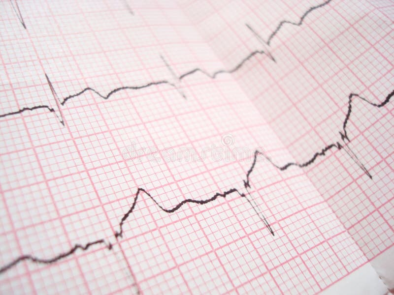 ECG Electrocardiography Diagram Stock Image - Image of electrical ...