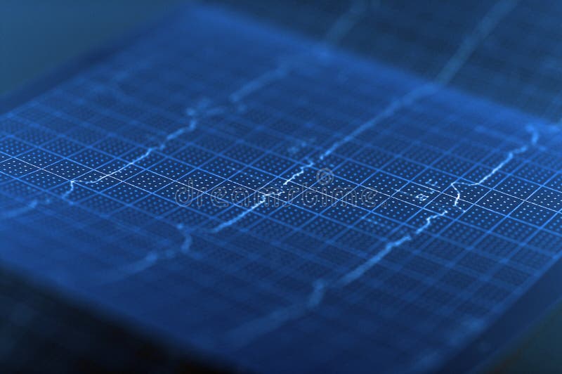 ECG-Elektrocardiogram stock afbeelding. Image of spanning - 38384823