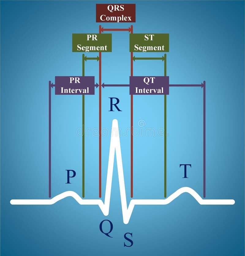 Ecg of Elektrocardiogram Met Qrs Complex Stock Illustratie ...