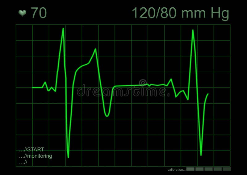 ECG graph stock illustration. Illustration of cardiology - 1058678