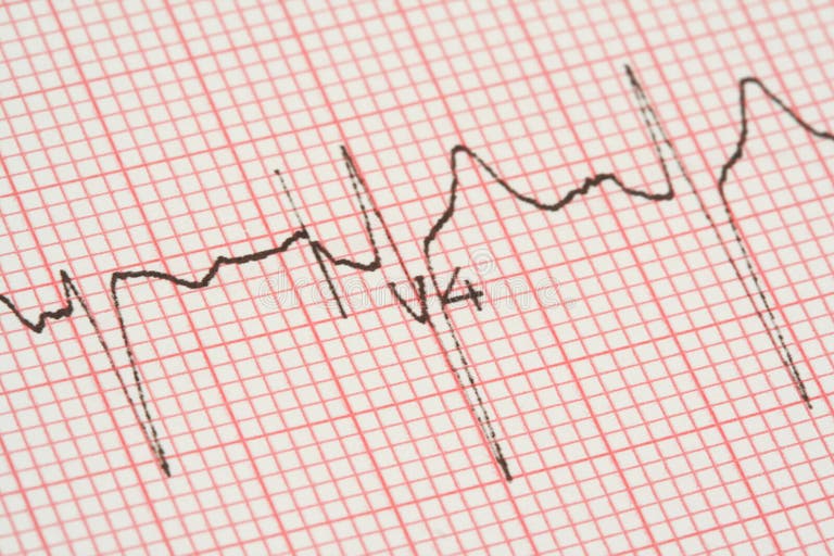 2,565 Ecg Graph Paper Stock Photos - Free & Royalty-Free Stock Photos ...