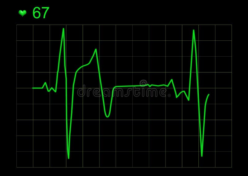 ECG graph stock illustration. Illustration of hospital - 261280