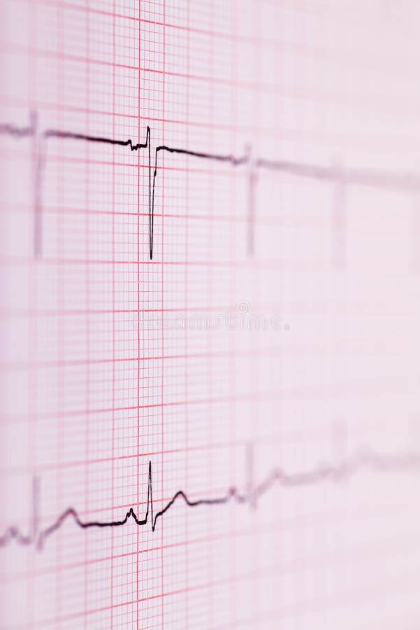 ECG graph stock photo. Image of laboratory, chart, healthcare - 27604038
